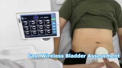 Wireless 4D Bladder Scanner BS1 Portable Point of Care