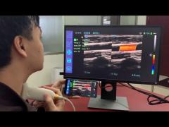 iTrason USB linear ultrasound probe used on smart phone/PC