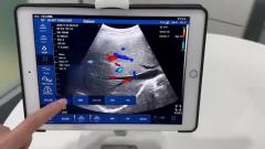 Wireless Handheld Ultrasound All In Solution