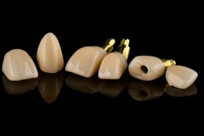 Chine Implant de remplacement de dent unique au sable de titane avec stérilisation par rayonnement gamma à vendre