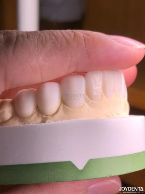 Cina Cere digitali di diagnosi personalizzate per la replicazione dell'anatomia naturale dei denti in vendita