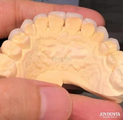 Cina Sfumature personalizzate per abbinare i denti naturali Biocompatibili e resistenti alle macchie Finiture dentali in vendita