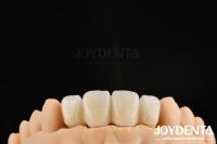 Quality Biologically Oriented Preparation Technique BOPT For Accurate Dental Preparation for sale