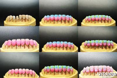 Cina Alta biocompatibilità Finitura ceramica feldspatica lucida per restauri dentali in vendita