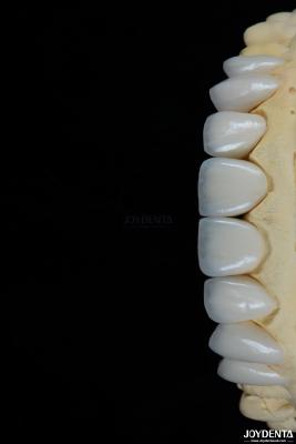 Cina Tessitura superficiale lucida Finitura feldspatica di aspetto naturale Finitura di porcellana in vendita