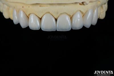Cina Tessitura superficiale lucida Finitura feldspatica di aspetto naturale Finitura di porcellana in vendita