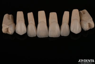 China Feldspathic Natural Looking Cosmetic Veneers Precise Fit Highly Translucent for sale