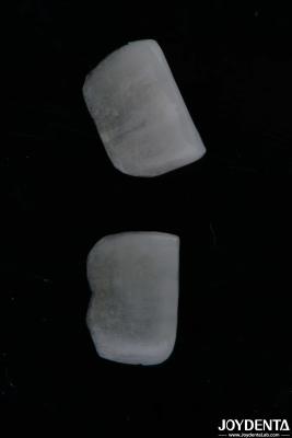 Cina Dental Fieldspathic Veneer di lunga durata Colore naturale dei denti Aspetto trasparente in vendita