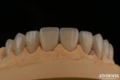 Cina Finitura dentale feldspatica ad adattamento preciso altamente naturale con una consistenza superficiale lucida in vendita