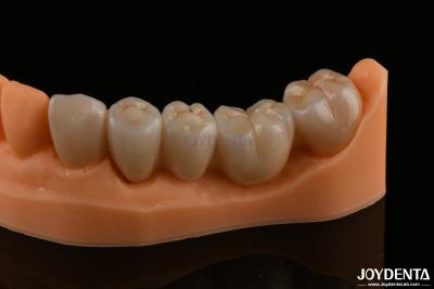 Cina Restaurazioni dentali di precisione Zirconia completa Alta resistenza flessibile Colore naturale in vendita