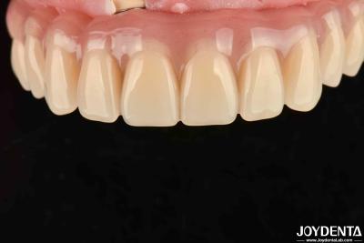 China Snelle drooging 5 minuten Acryl tanden afwerking voor tandheelkundige tandherstel Te koop