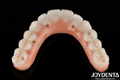 China Barras de titanio de larga duración puente híbrido de zirconia aspecto natural estética para la restauración en venta