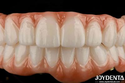 Cina Bar di titanio di lunga durata Zirconia Hybrid Bridge Aspetto naturale Estetica per restauro in vendita