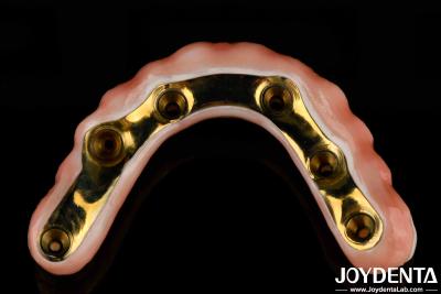 China Barras de titanio de larga duración puente híbrido de zirconia aspecto natural estética para la restauración en venta