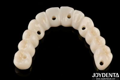 Cina Ponte di impianto ibrido di zirconia liscia che ripristina la funzione di masticazione su misura in vendita