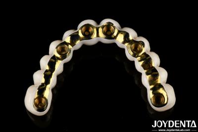 Cina Ponte di impianto ibrido di zirconia liscia che ripristina la funzione di masticazione su misura in vendita