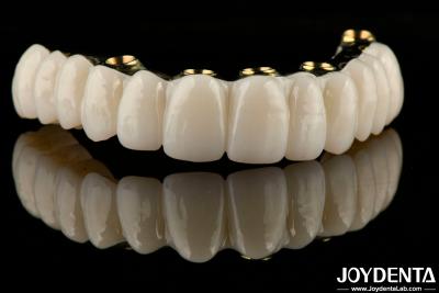 Cina Ponte di impianto ibrido di zirconia liscia che ripristina la funzione di masticazione su misura in vendita