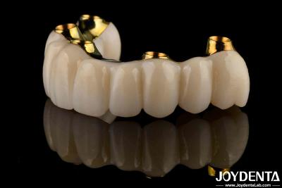 Cina Precisione dentale Bar di titanio ibrido Zirconia Ponte personalizzazione Alta biocompatibilità in vendita