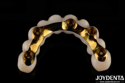 Cina Precisione dentale Bar di titanio ibrido Zirconia Ponte personalizzazione Alta biocompatibilità in vendita