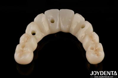 Cina Precisione dentale Bar di titanio ibrido Zirconia Ponte personalizzazione Alta biocompatibilità in vendita