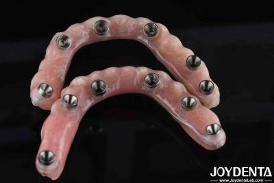Cina Finitura di denti in acrilico per alta resistenza all'usura in vendita
