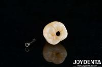 China Precision Titanium Finished Abutments with Zero Angulation and Internal Hex Connection for Dental Implants for sale