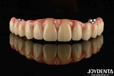 Cina Confortevole Indossare Titanio Malong Hybrid Bridge Dental Disegno regolabile Peso leggero in vendita
