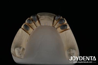 China Steel Locator Dental Attachments , Precision Partial Denture Attachments Removable for sale