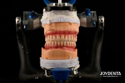 中国 軽量 コンフォート フィット アクリル 歯科 歯科 パーソナライゼーション 販売のため