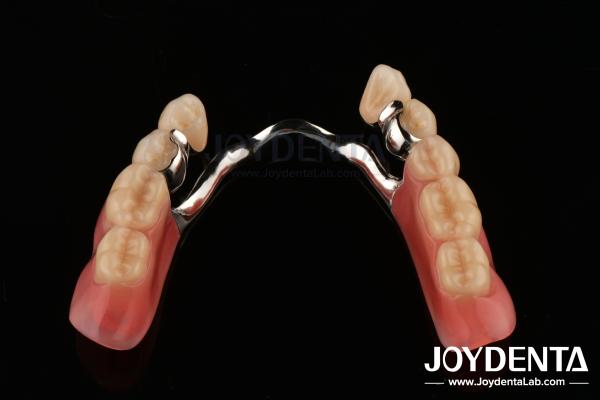 Impianto strutturale Denti di finitura Tecnologia elaborata Belle aspetto armonioso Disegno