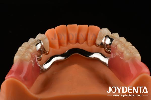 Impianto strutturale Denti di finitura Tecnologia elaborata Belle aspetto armonioso Disegno