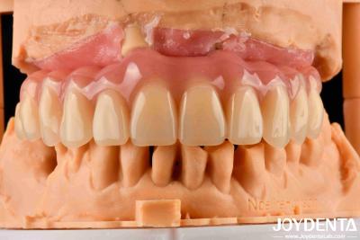 Cina Confortevole indossare protesi dentali acriliche con tecnologia di arrangiamento dei denti in vendita