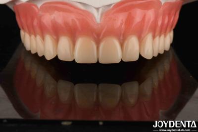 Cina Denti Acrilici Finitura Materiale di resina leggero Restaurazioni dentali Disposizioni dentali in vendita