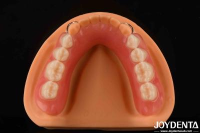 Cina Personalizzazione Protesi dentale acrilica Finitura leggera Alta elasticità in vendita