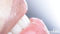 Quality Long Lasting Dental Composite Veneer Good Biocompatibility No Drop Off porcelain for sale