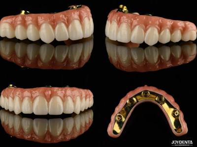 Cina Ti Bar Zirconia Hybrid Implant Bridges High Translucency per protesi dentali in vendita