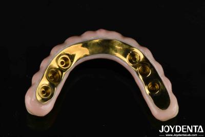 China Alta durabilidad Zirconia Solución definitiva para la compatibilidad de los dientes y las encías naturales en venta