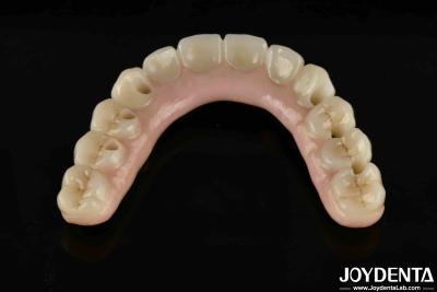 China Alta durabilidad Zirconia Solución definitiva para la compatibilidad de los dientes y las encías naturales en venta