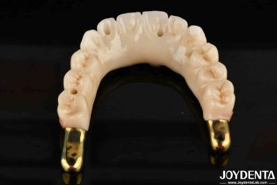 China Próteses Dentárias Ti-Bar Zirconia Hybrid Bridge com altos padrões de biocompatibilidade à venda