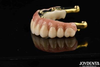 China Próteses Dentárias Ti-Bar Zirconia Hybrid Bridge com altos padrões de biocompatibilidade à venda