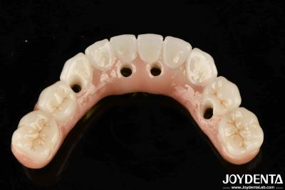 China Titanio y zirconio confort confortable para usar Ti-Bar zirconio puente híbrido para reemplazar los dientes perdidos en venta