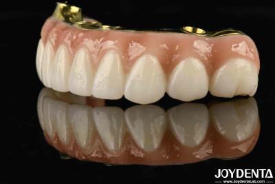 China Titanio y zirconio confort confortable para usar Ti-Bar zirconio puente híbrido para reemplazar los dientes perdidos en venta