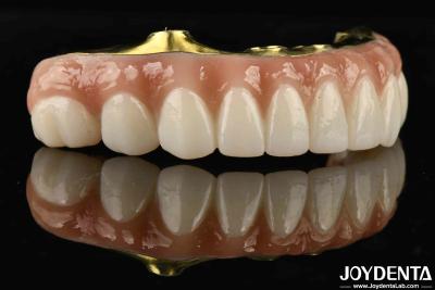 China Titanio y zirconio confort confortable para usar Ti-Bar zirconio puente híbrido para reemplazar los dientes perdidos en venta