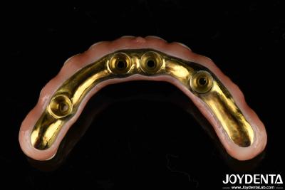 China Titanio y zirconio confort confortable para usar Ti-Bar zirconio puente híbrido para reemplazar los dientes perdidos en venta