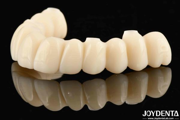 Customizable Ti-Base Zirconia Hybrid Bridge With Excellent Durability And Good Biocompatibility