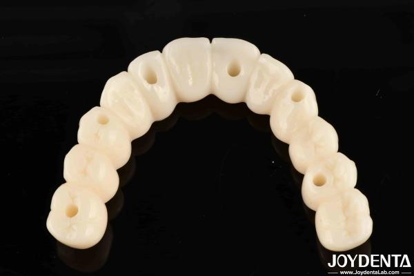 Customizable Ti-Base Zirconia Hybrid Bridge With Excellent Durability And Good Biocompatibility