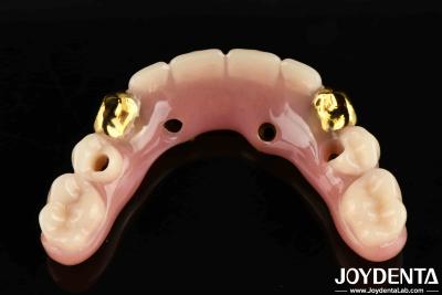 China Clear And Mild Odor Ti-Bar Acrylic Teeth Finish For Dental Solution for sale