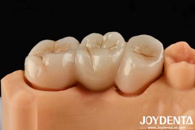 China Experience Color Realistic Full Zirconia With High Resistance To Staining And Flexural Strength Of 1000 MPa for sale