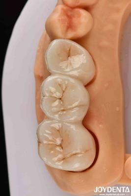 China Experience Color Realistic Full Zirconia With High Resistance To Staining And Flexural Strength Of 1000 MPa for sale