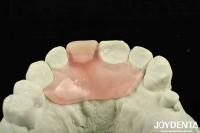 China Personalized Customization Flexible Denture Finish using Tooth Arrangement Technology with Good Elasticity for sale